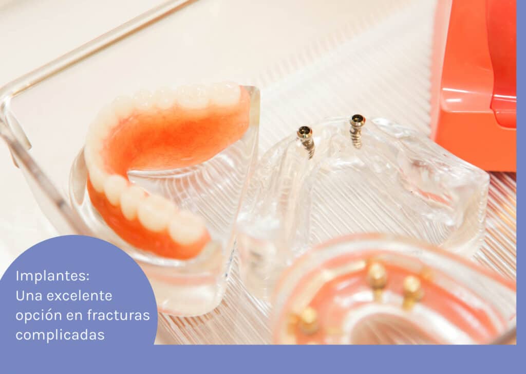 Breaking Down Dental Fractures: Guide to Treatment and Recovery